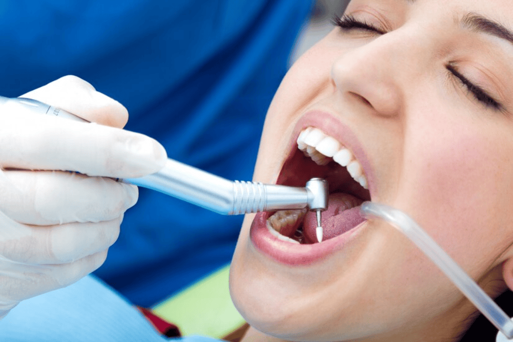 How Long Do Dental Sealants Last? Understanding Their Lifespan