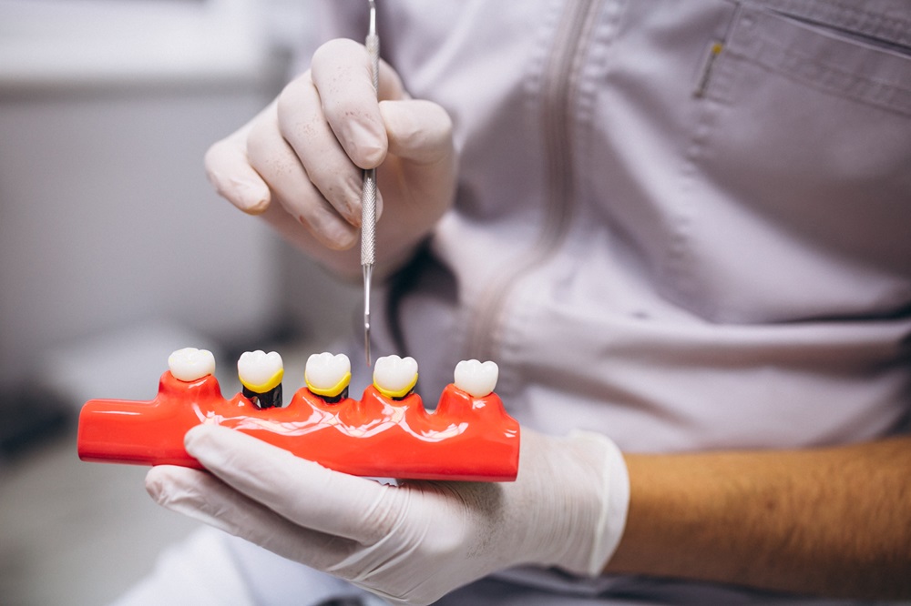What Are the Different Types of Material for Dental Crowns?